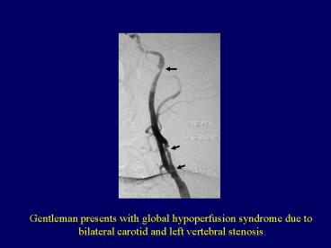 PPT – Gentleman presents with global hypoperfusion syndrome due to ...