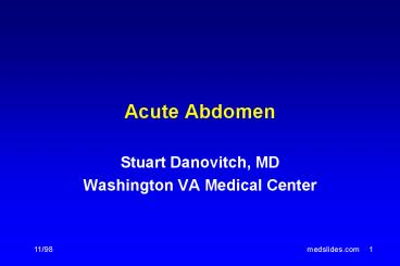 Acute Abdomen presentation | free to view
