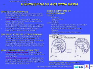 PPT – HYDROCEPHALUS AND SPINA BIFIDA PowerPoint presentation | free to ...