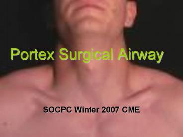 Portex Surgical Airway presentation | free to view
