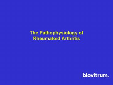 The Pathophysiology of Rheumatoid Arthritis presentation | free to view