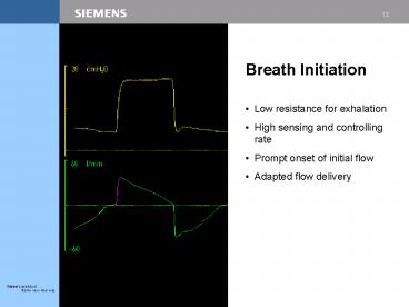 Comparison of four ventilators' Chart kindly provided by M'Heulett ...