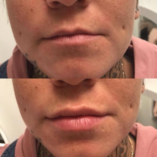 Atlanta Medical Aesthetics - Skincare Specialist, 12th & Midtown ...