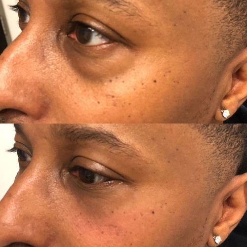 Atlanta Medical Aesthetics - Skincare Specialist, 12th & Midtown ...