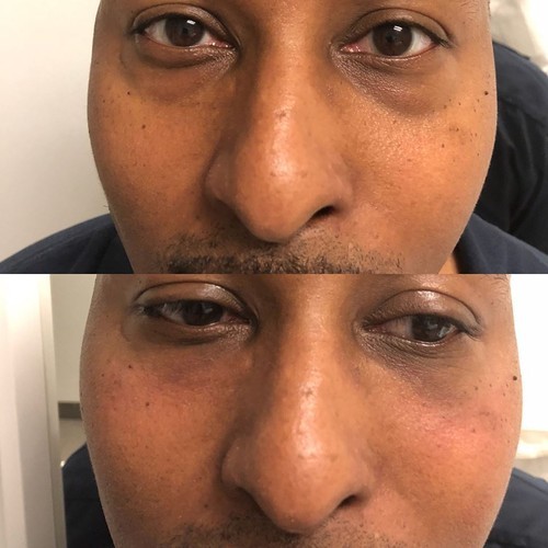 Atlanta Medical Aesthetics - Skincare Specialist, 12th & Midtown ...