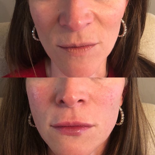 Atlanta Medical Aesthetics - Skincare Specialist, 12th & Midtown ...