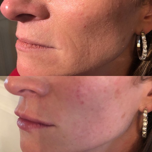 Atlanta Medical Aesthetics - Skincare Specialist, 12th & Midtown ...