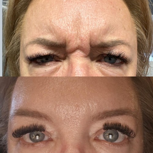 Root Medical Aesthetics - Skincare Specialist, Cherry Creek - Denver ...
