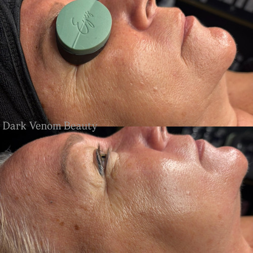 Dark Venom Beauty - Skincare Specialist, St Augustine - St. Augustine ...