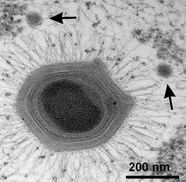 Using DNA To Trace The Origins Of Giant Viruses - Astrobiology