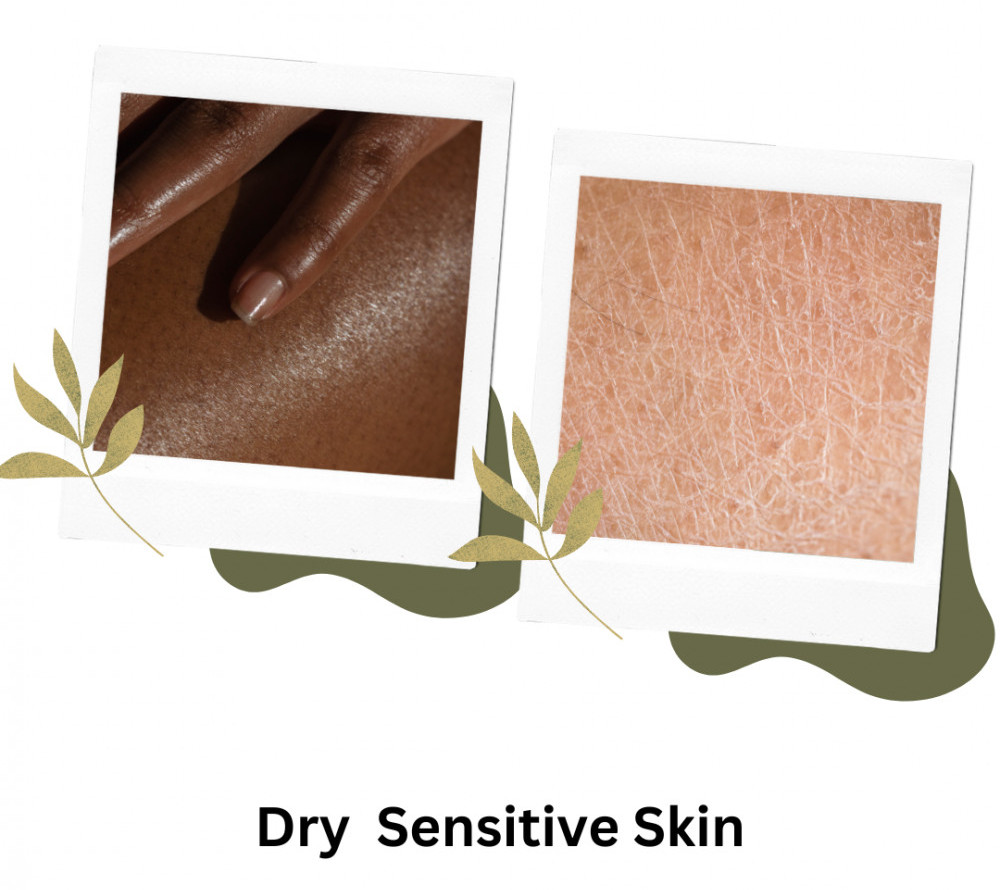 Understanding the Science of Dry Sensitive Skin: Causes, Treatment and ...