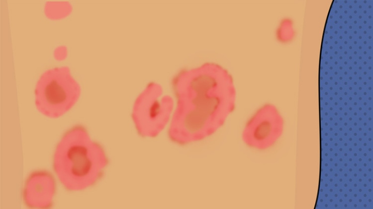 If You’re Noticing These Signs, You Need to Take Your Rash to a Doctor ASAP