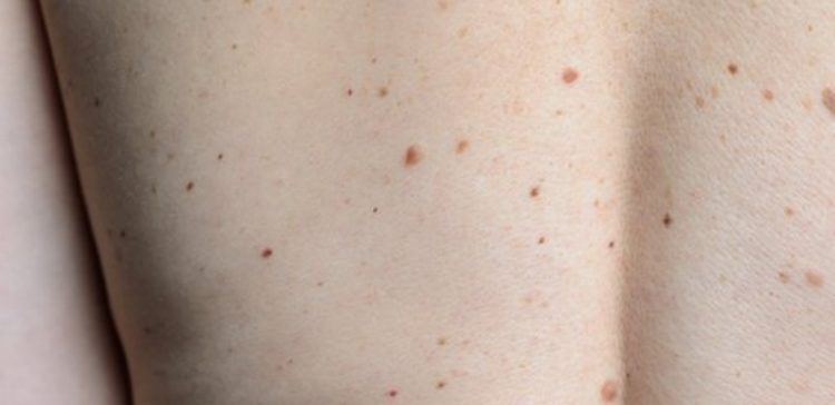 7 Skin Issues That Could Be Warning Signs of Serious Health Problems