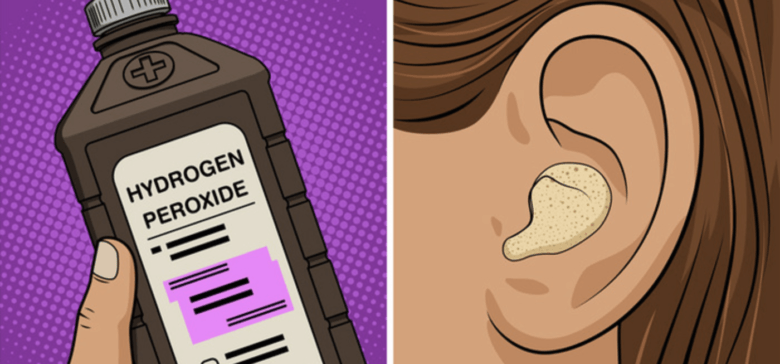 Here Are 15 Reasons Why Mom Always Kept Hydrogen Peroxide on Hand