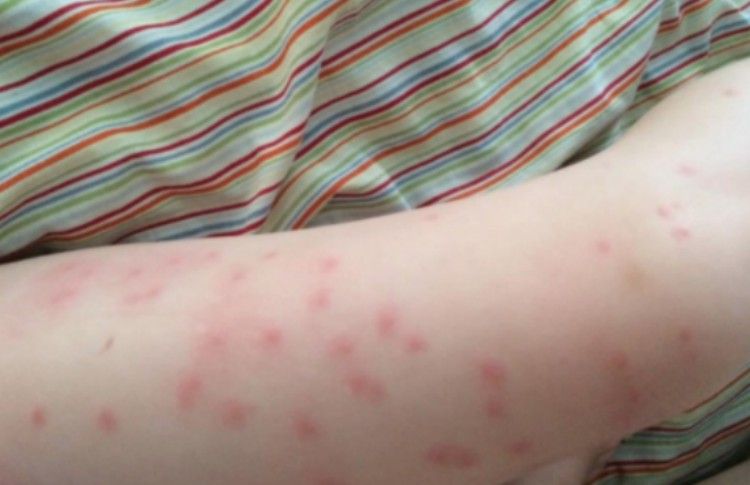 Mom Confronts a Horrifying Truth After Finding Mysterious Black Dots on ...
