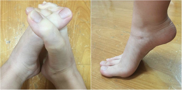 You’ve Never Seen Toes Like These