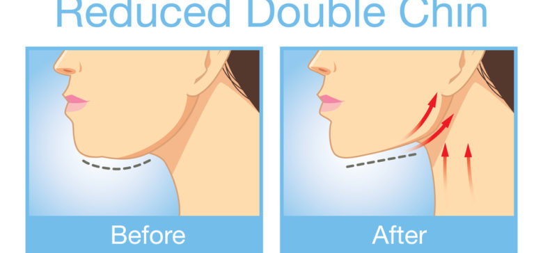 Do These 5 Exercises and Kiss Your Double Chin Goodbye