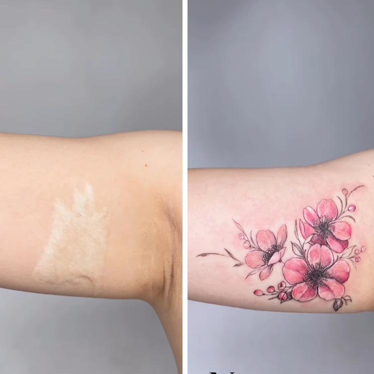 10 Times People Used Tattoos To Cover Up Their Scars