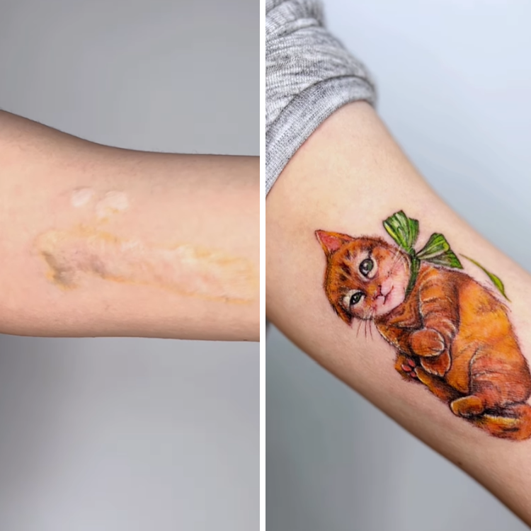10 Times People Used Tattoos To Cover Up Their Scars