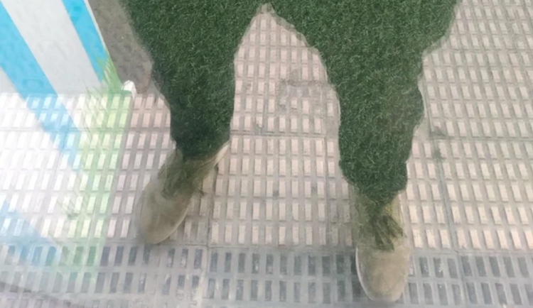 “Grass Pants” Optical Illusion Has the Internet Completely Stumped