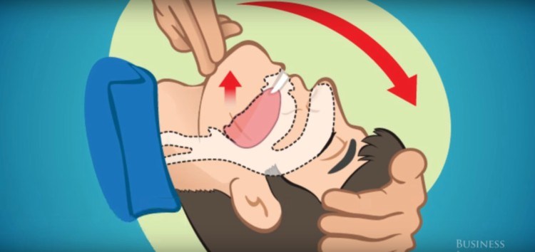 The Little Known Reason Why There Are Holes in Pen Caps