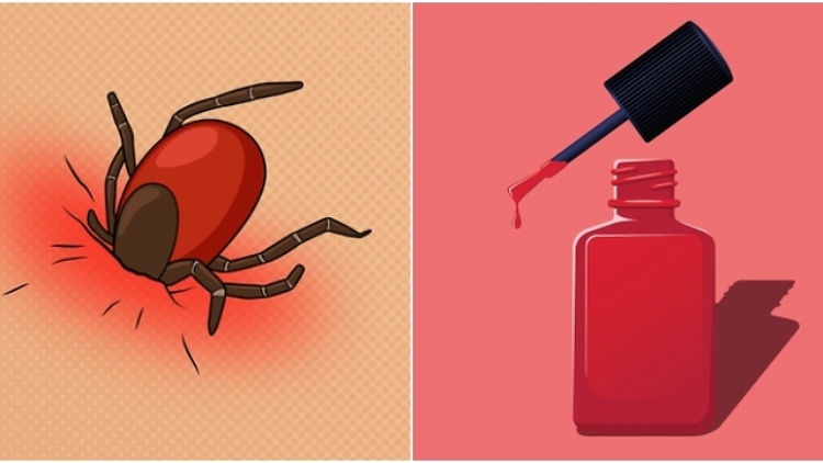 Here’s the Truth About That Nail Polish Tick Removal Trick