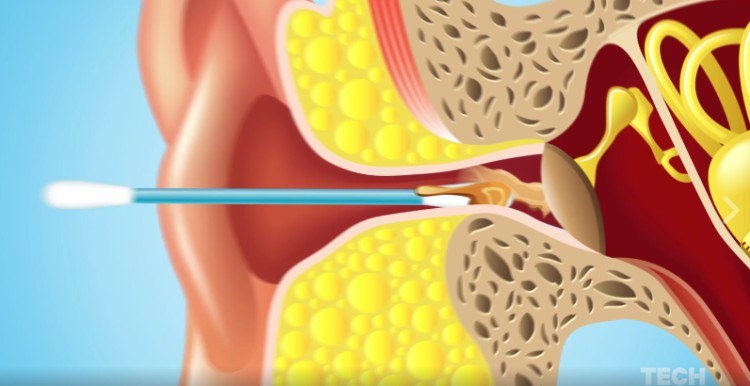 What Really Happens When You Put A Q Tip In Your Ear