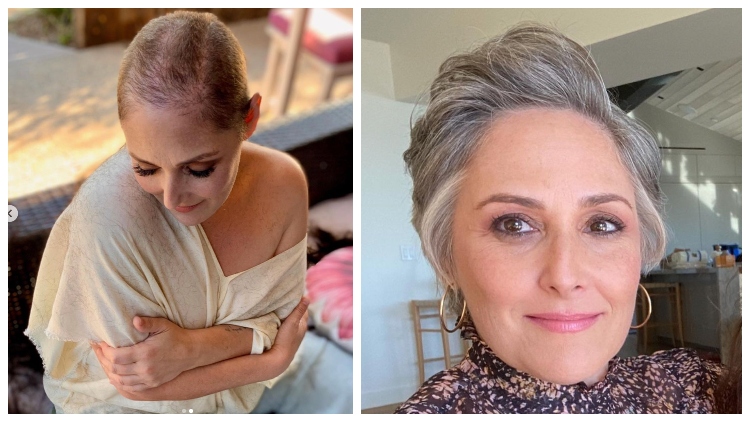 Ricki Lake Opens Up About Her Debilitating Hair Loss After Silently ...