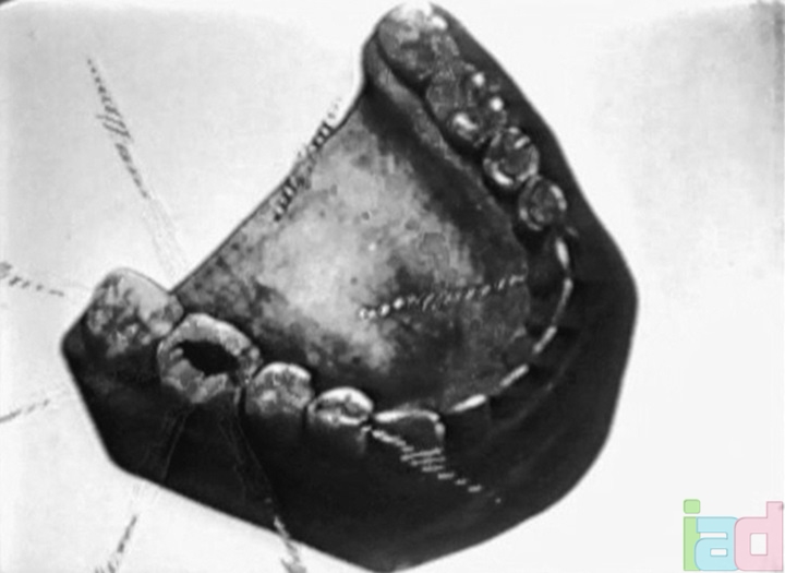 Tommy Tucker's Tooth (1922) - The Internet Animation Database