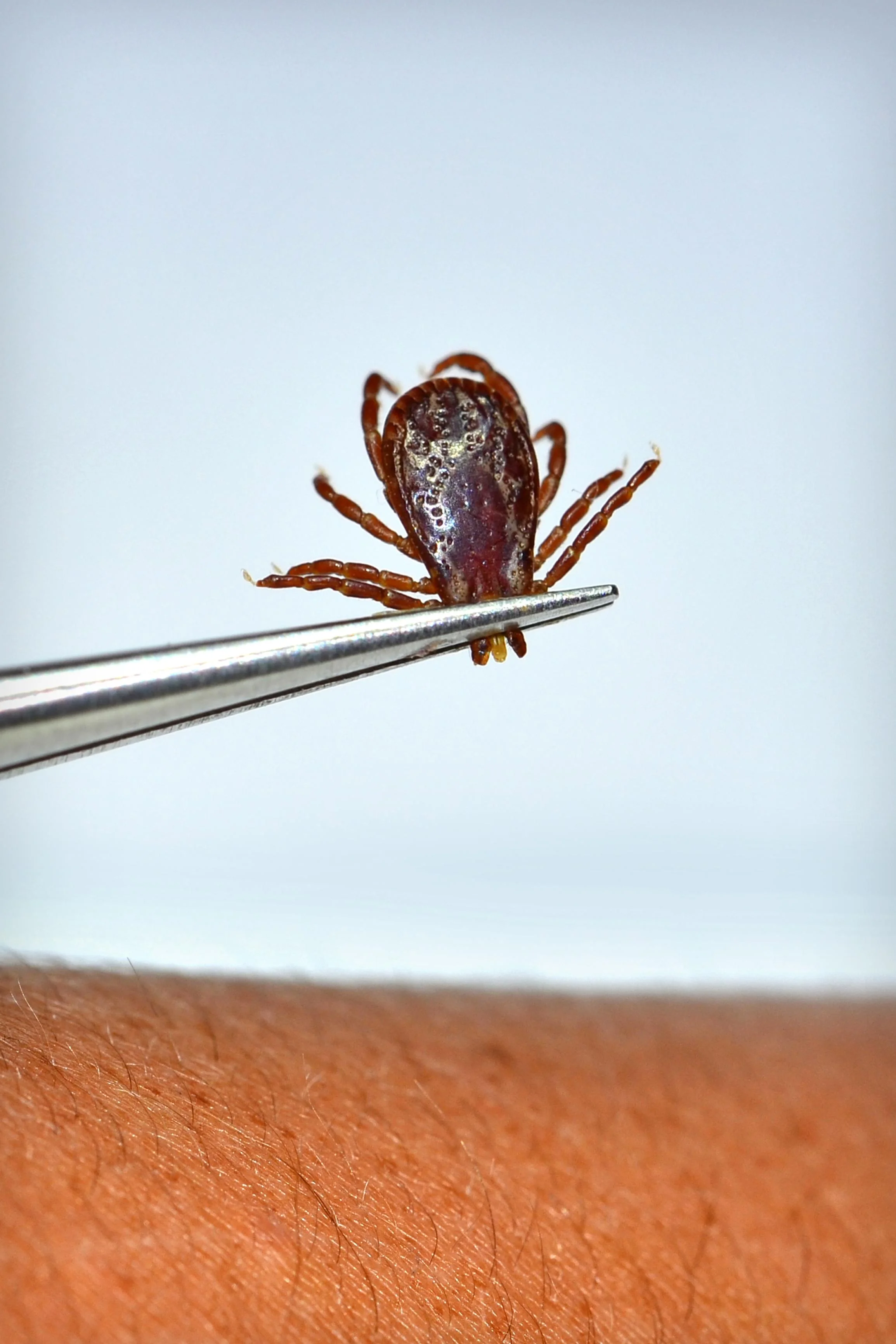 A Cautionary Tale of Ticks | South Shore Press