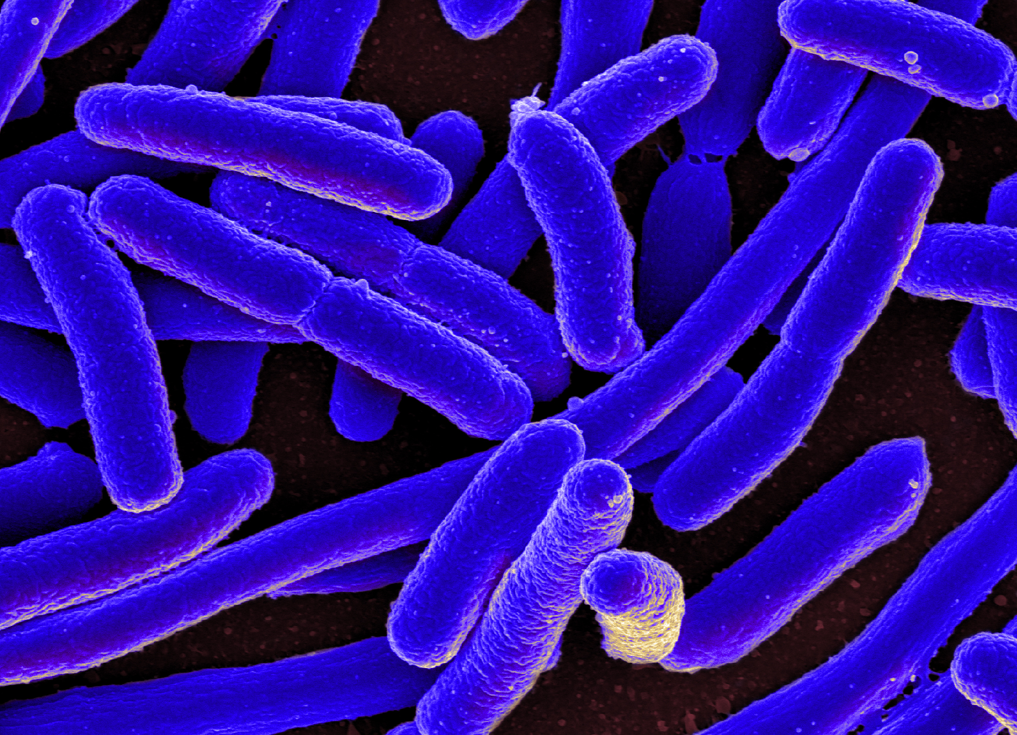 Antibiotic discovered with never-before-seen method of killing bacteria ...