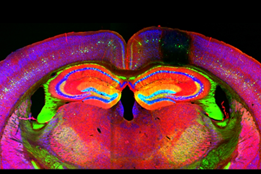 Brain Cells Under Attack Don ‘Body Armor’ Response, Offering New Views ...