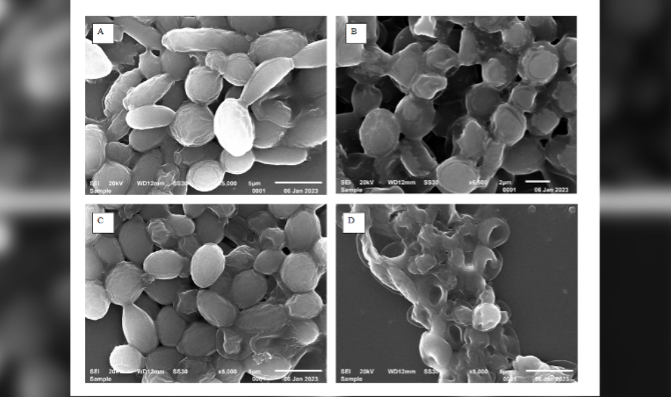 Rare Yeast Pathogen Causes Neonatal Outbreaks and Is Evolving Quickly ...