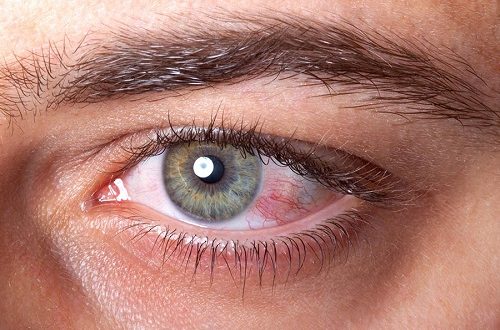 Aumentan daños oculares por exposición prolongada a las pantallas ...