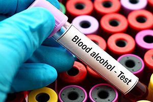 Warrantless Blood Draw from DUI Suspect