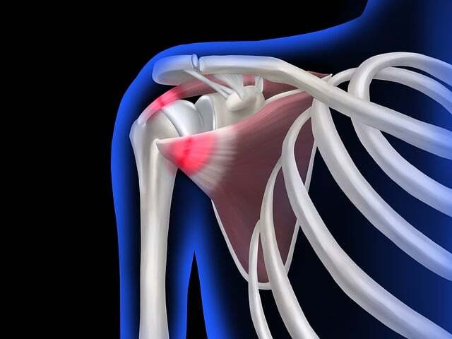 Understanding Shoulder Injuries And Their Legal Implications