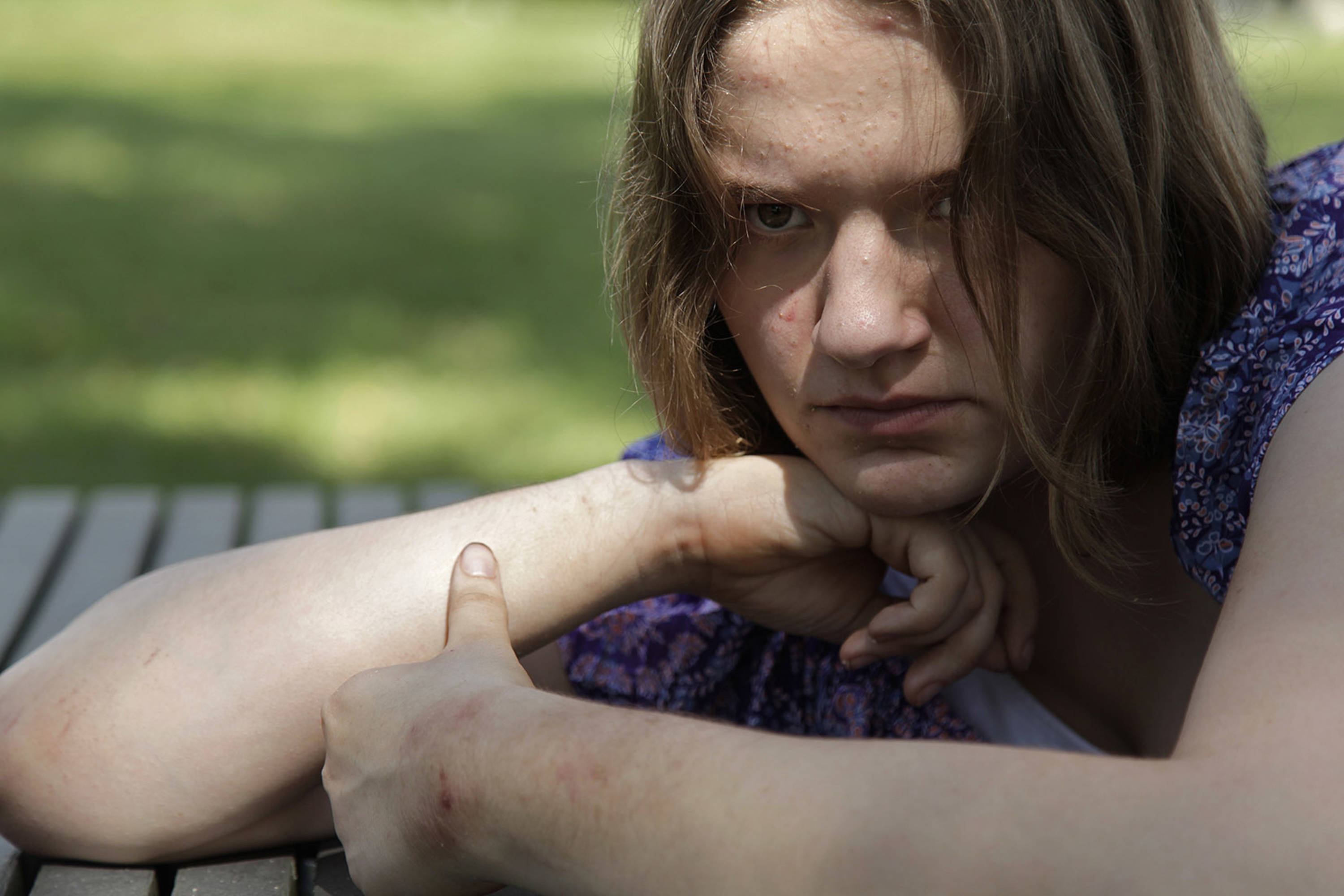 The Girl in the Window, 10 years later | Features | Tampa Bay Times