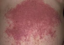 Home - Dermatology - LibGuides at Riphah International University