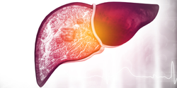 Say goodbye to biopsies, non-invasive diagnostics for fatty liver ...