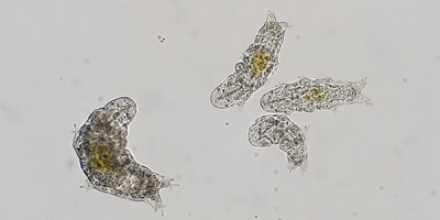 Tardigrades protect proteins on the brink of death | Drug Discovery News
