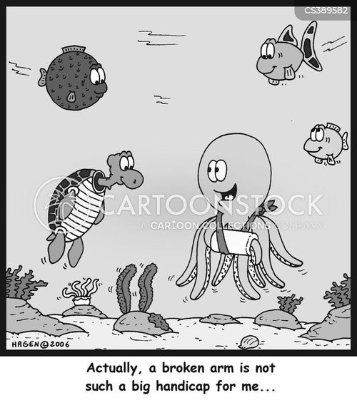Arm Casts Cartoons and Comics - funny pictures from CartoonStock