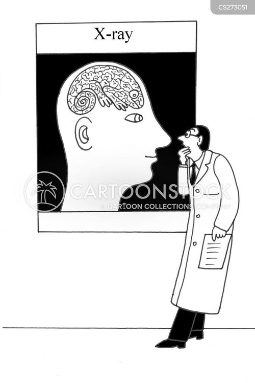 Brain Scan Cartoons and Comics - funny pictures from CartoonStock