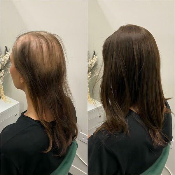 Full Lace Hair Toppers: The Best Way to Cover Thinning Hair