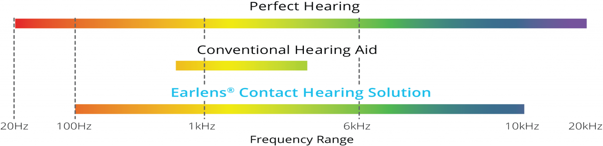 Earlens Hearing Solution - ENT Physicians Inc