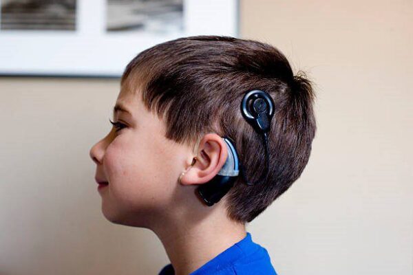 Everything You Need To Know About Cochlear Implants - Bluegrass Hearing ...