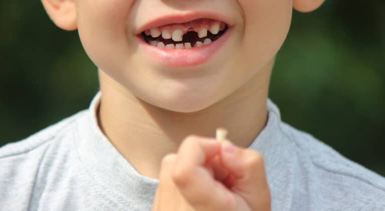 When will my child lose their baby teeth? - Valley Pediatric Dentistry