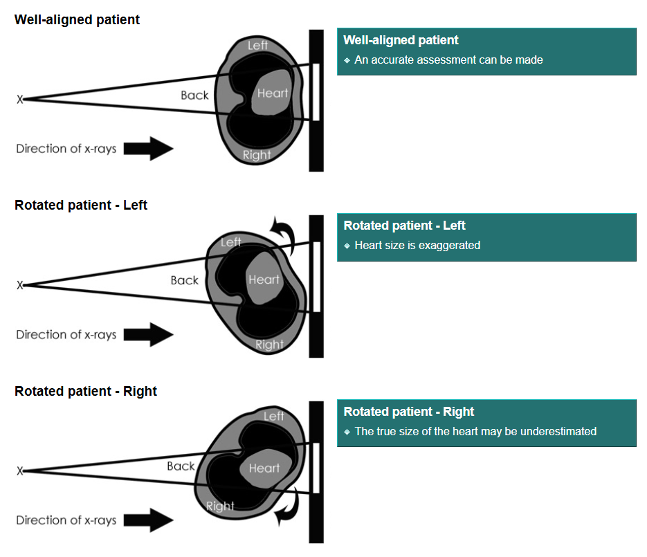 Anatomical Landmarks In Rotated Chest X-Rays | MetaNESTA