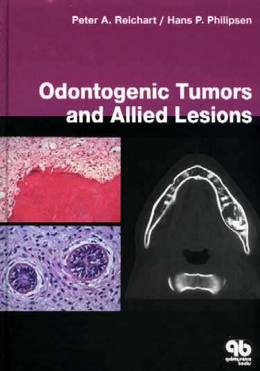 Matthews MUSC Bookstore : Odontogenic Tumors and Allied Lesions