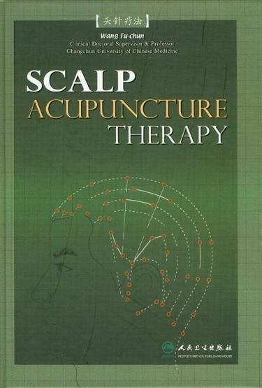 Campus Store : Scalp Acupuncture Therapy