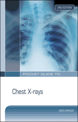 Matthews MUSC Bookstore : Pocket Guide to Chest X-rays